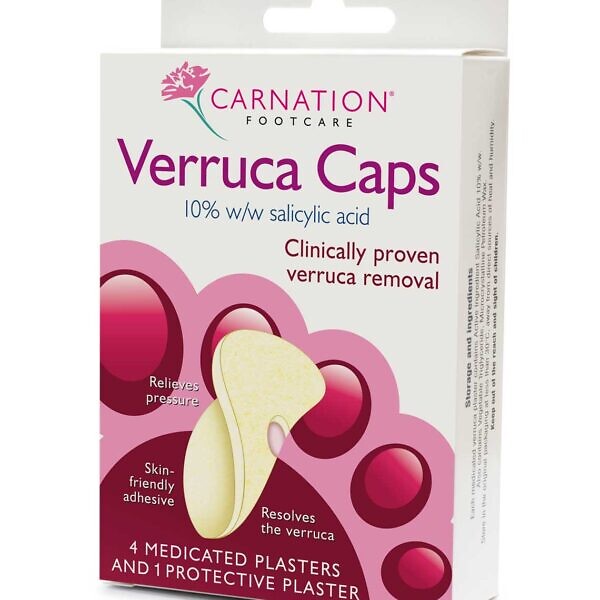 Verrucas - Carnation Footcare